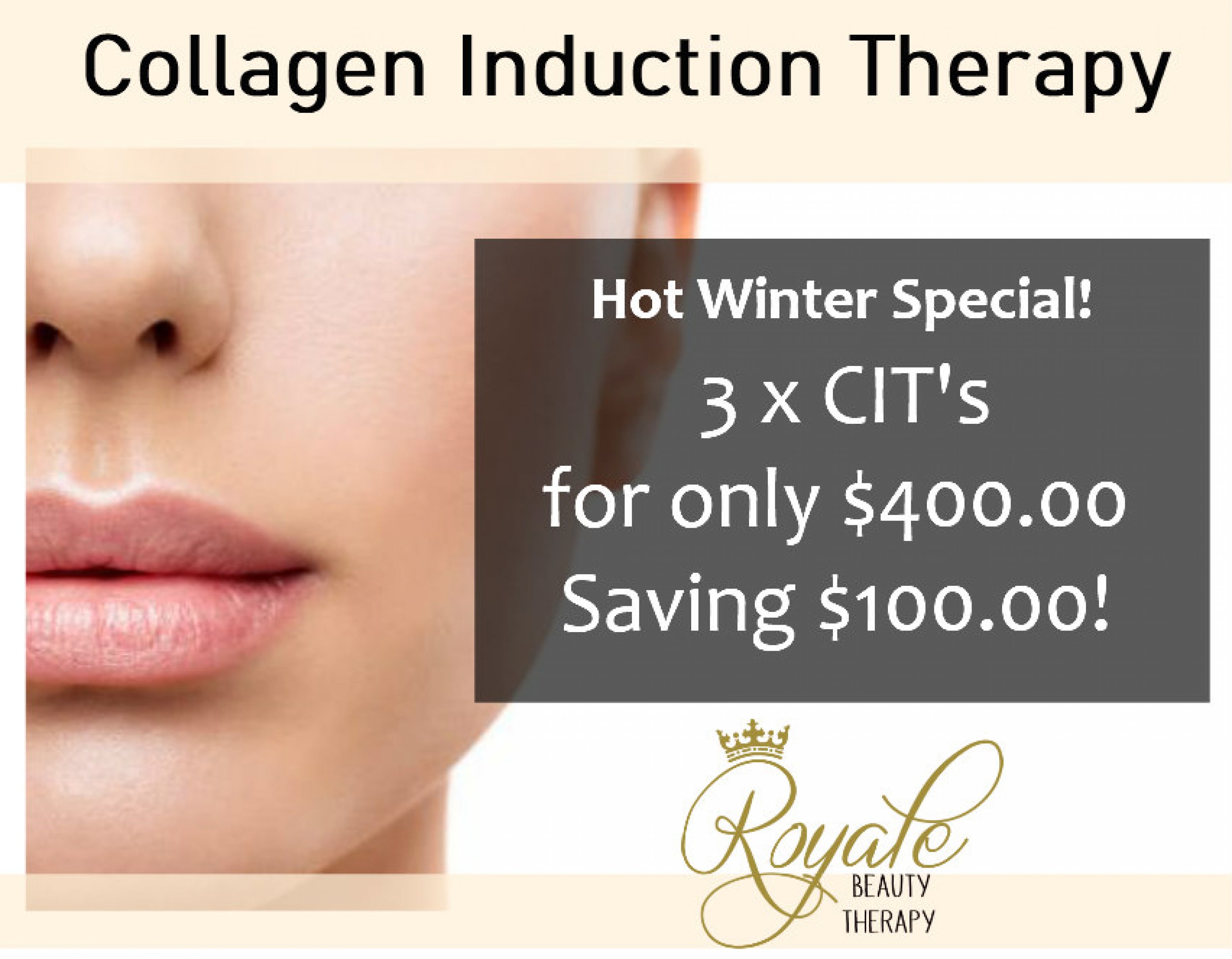 Collagen Induction Therapy | Royale Beauty Therapy